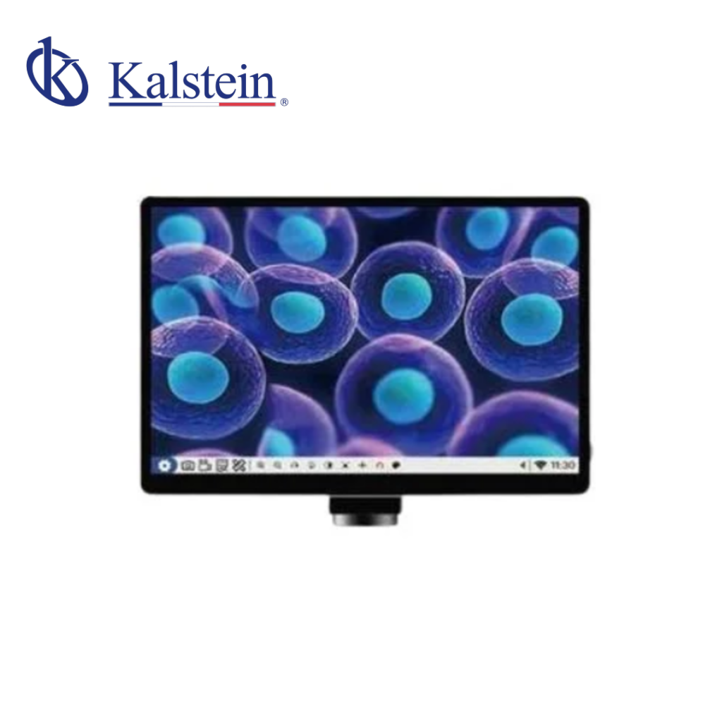 Innovative Digital Cameras: A Comparative Analysis of Kalstein vs ...