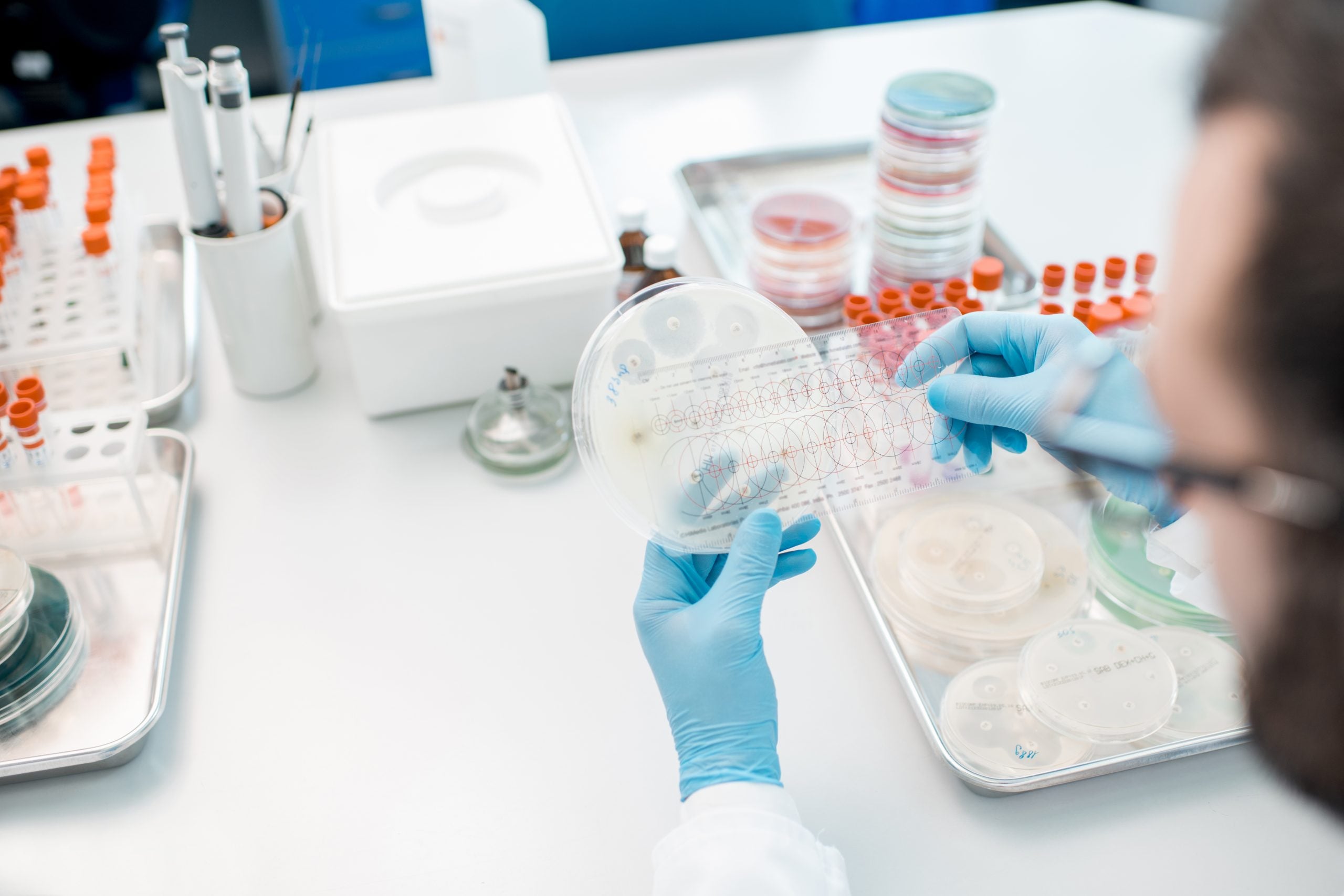 À quoi sert un lecteur ELISA ? - Kalstein